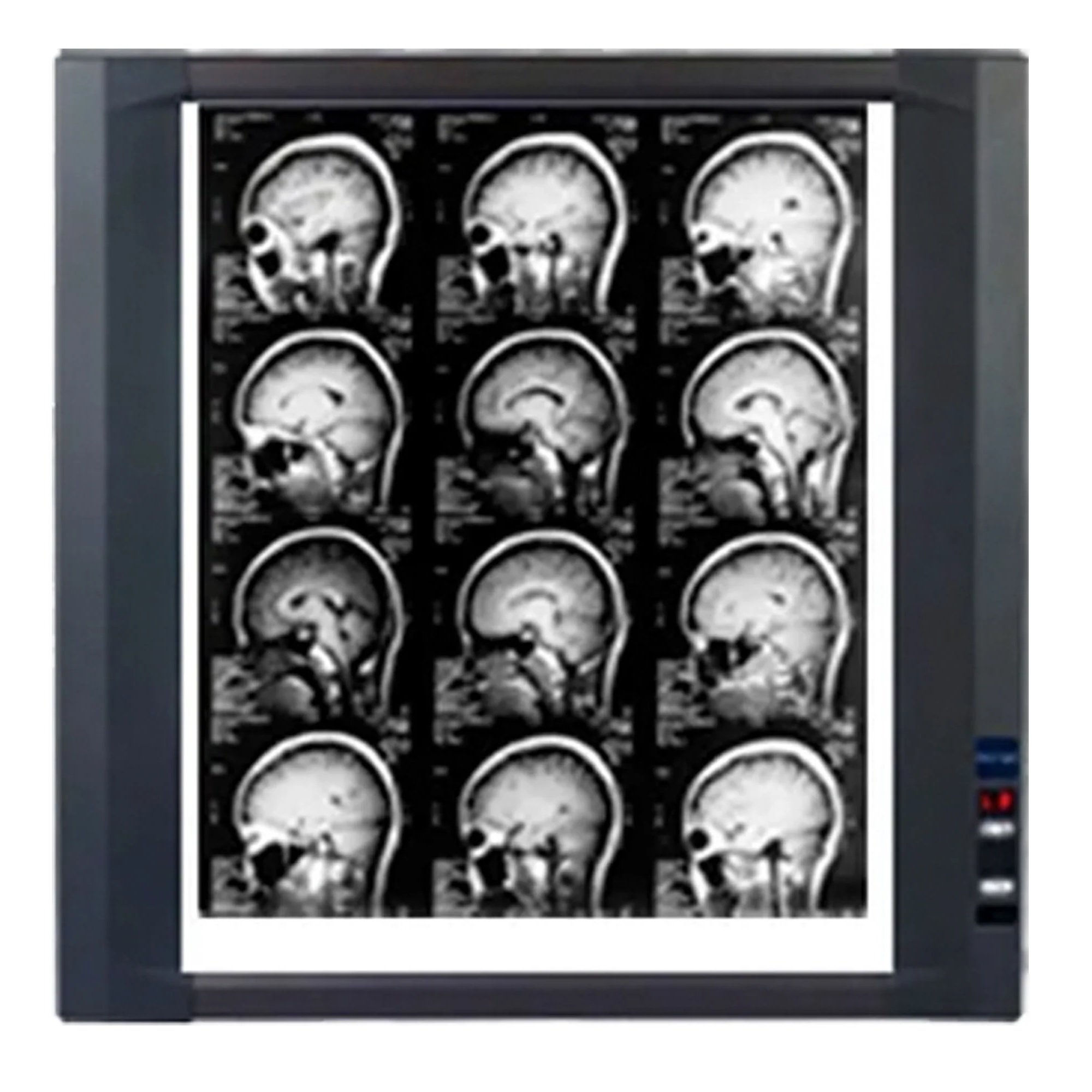 Negatoscopio sencillo de LED Mod. NGPII-1 con 8 niveles de intensidad ...