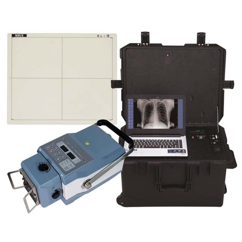 Sistema de radiografía portátil DR con pantalla táctil, marca SIUI, SIU ...