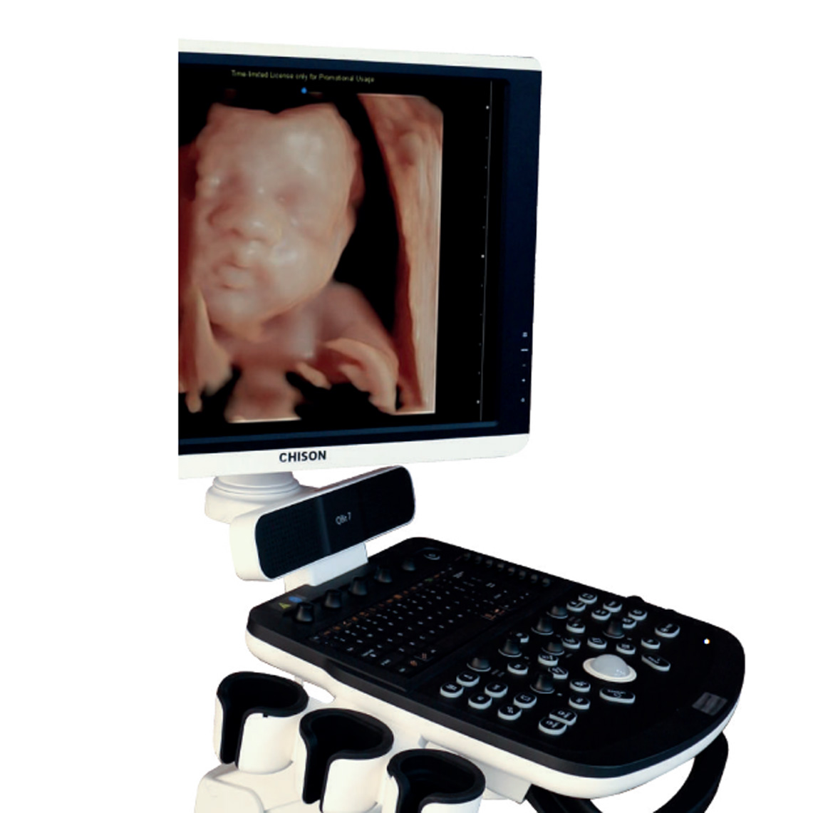 Ultrasonido Qbit 7 con 2 transductores (convexo, lineal o vaginal ...