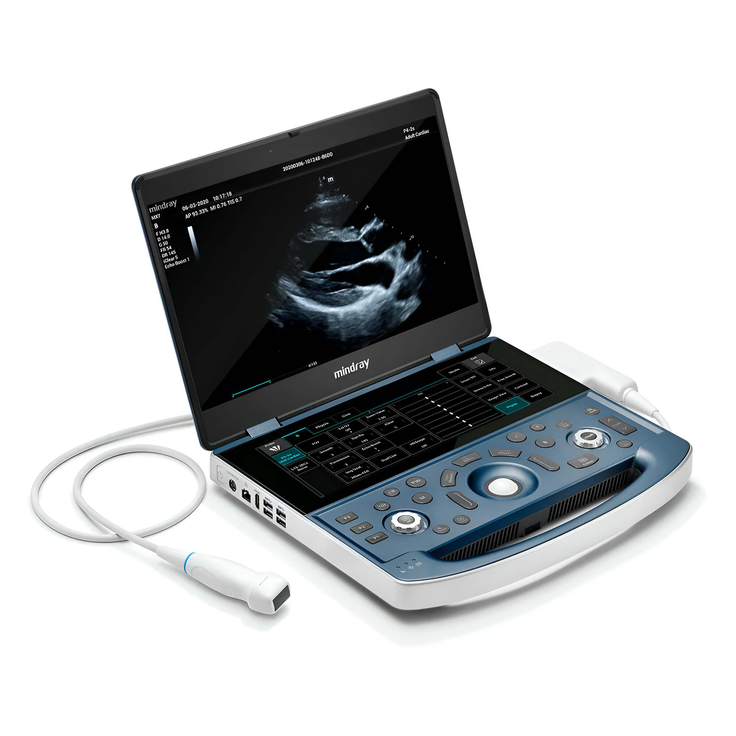 Sistema de ultrasonido portátil Mindray MX7 incluye transductor lineal, convexo y endocavitario ...